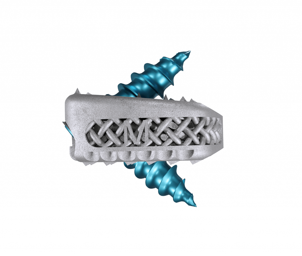 Magnolis® Z3 | cervical cage titanium cage with 3° lordosis